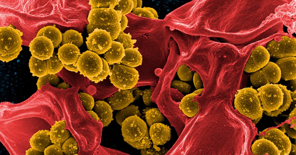 Revelan Que 39 Millones De Personas Podrían Morir Por Superbacterias