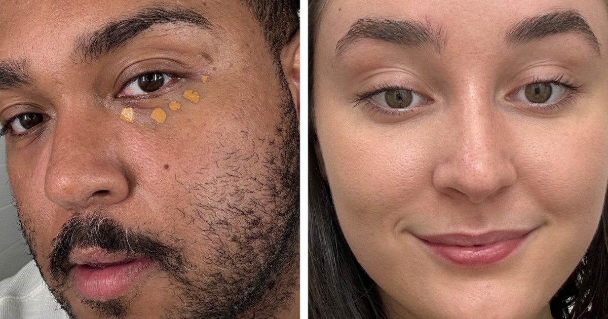 11 Best Concealers for Acne-Prone Skin in 2025, Tested and Reviewed