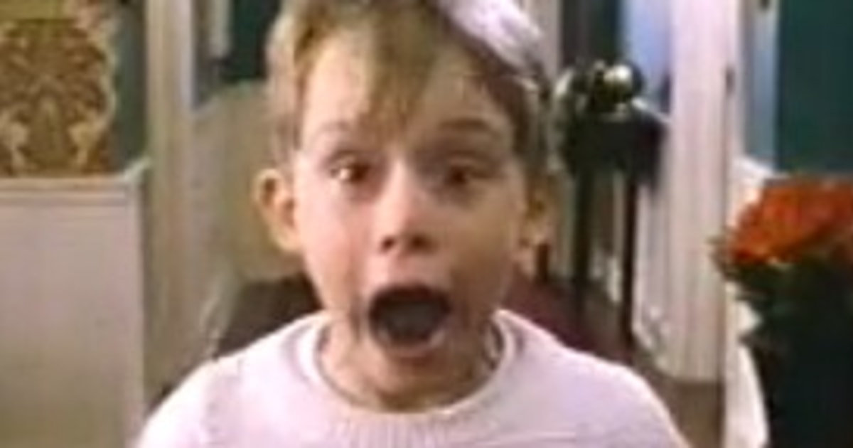 Doctor diagnoses 'Home Alone' Wet Bandit injuries