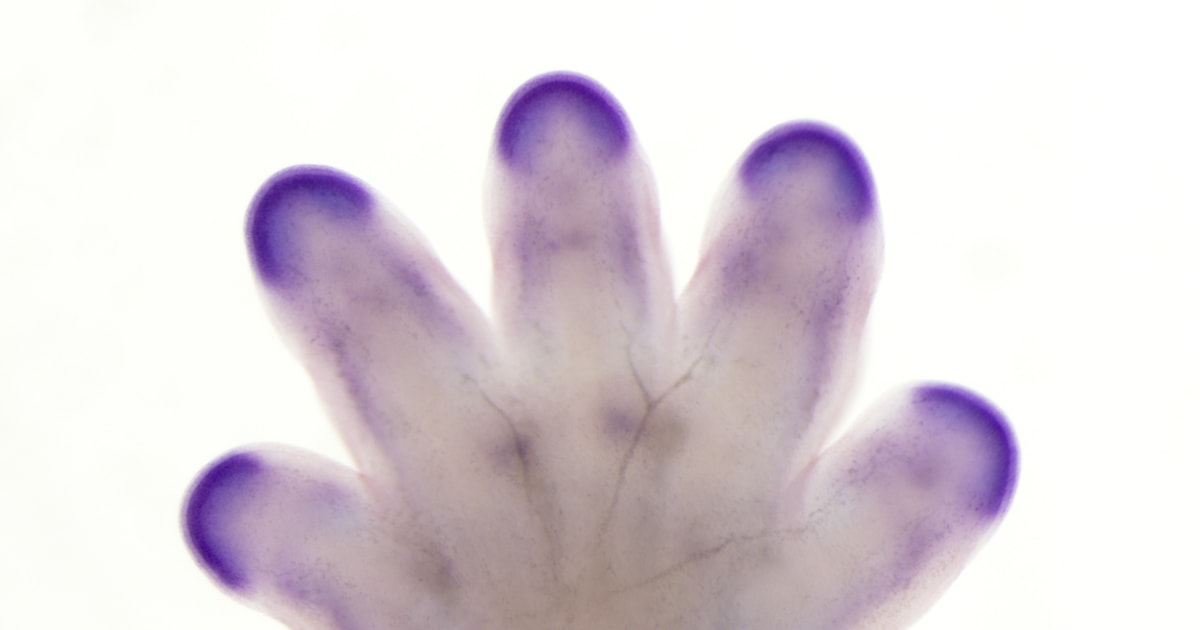 Regrowing human body parts: The dream comes within reach