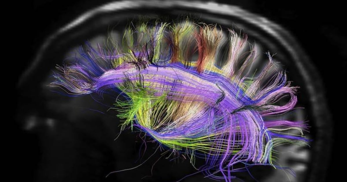 How researchers shaped the White House's brain-mapping initiative