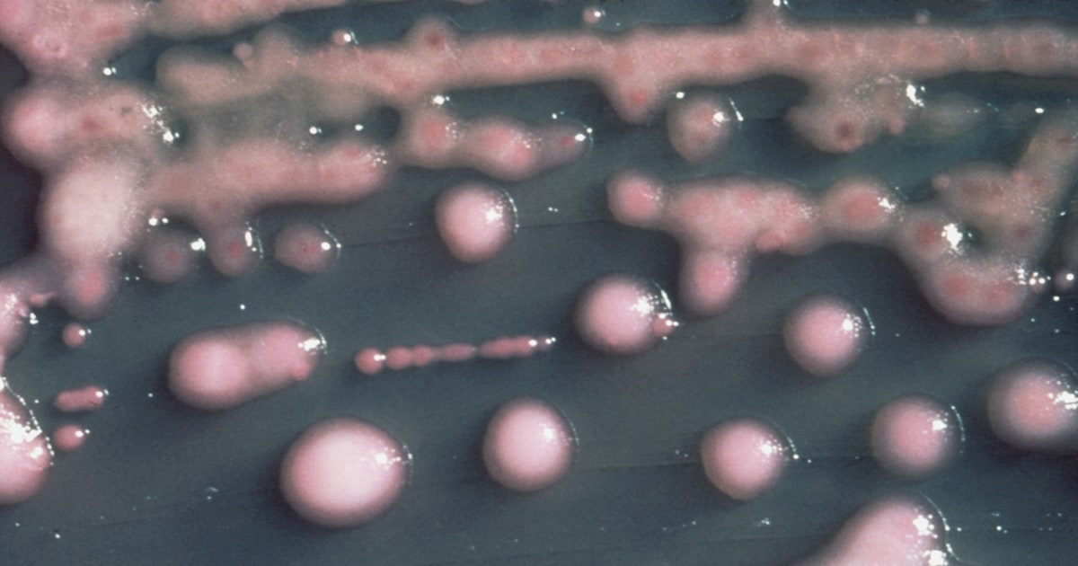 Reports of rare superbug jump in US, CDC says