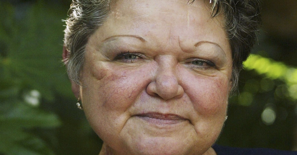 Star of 'Voicebox' anti-smoking ads dies after 20-year cancer battle