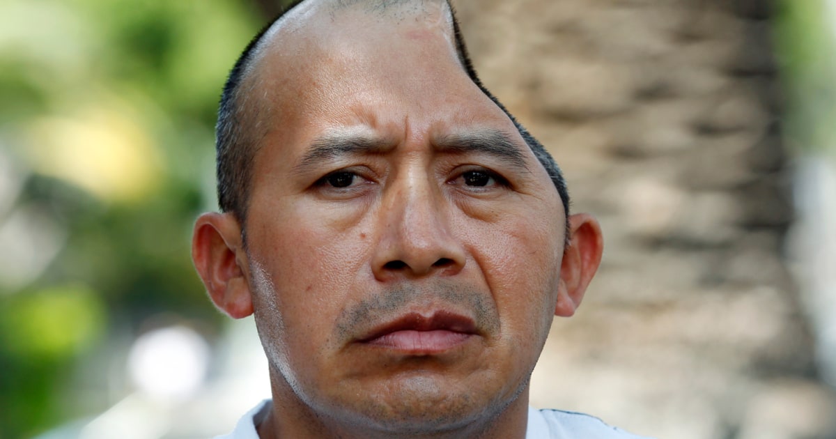 Man awarded $58 million after having skull bashed in bar fight