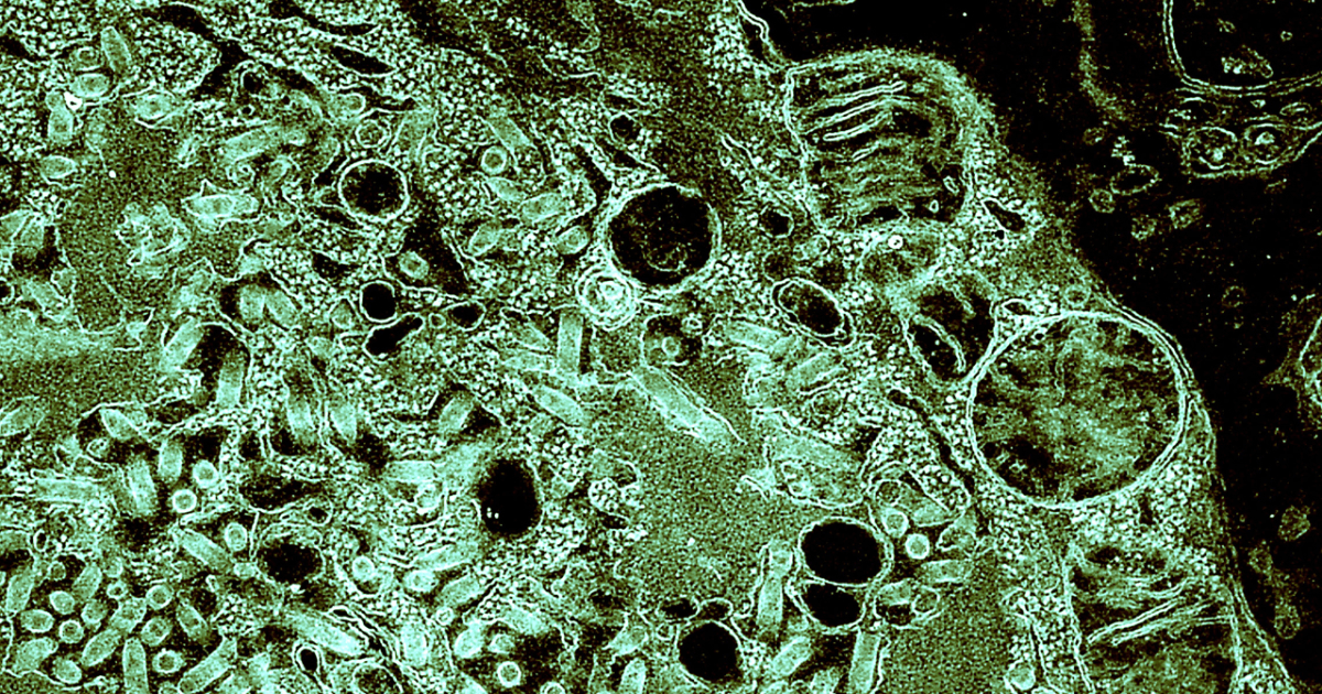 Patient killed by rabies from organ transplant, CDC says