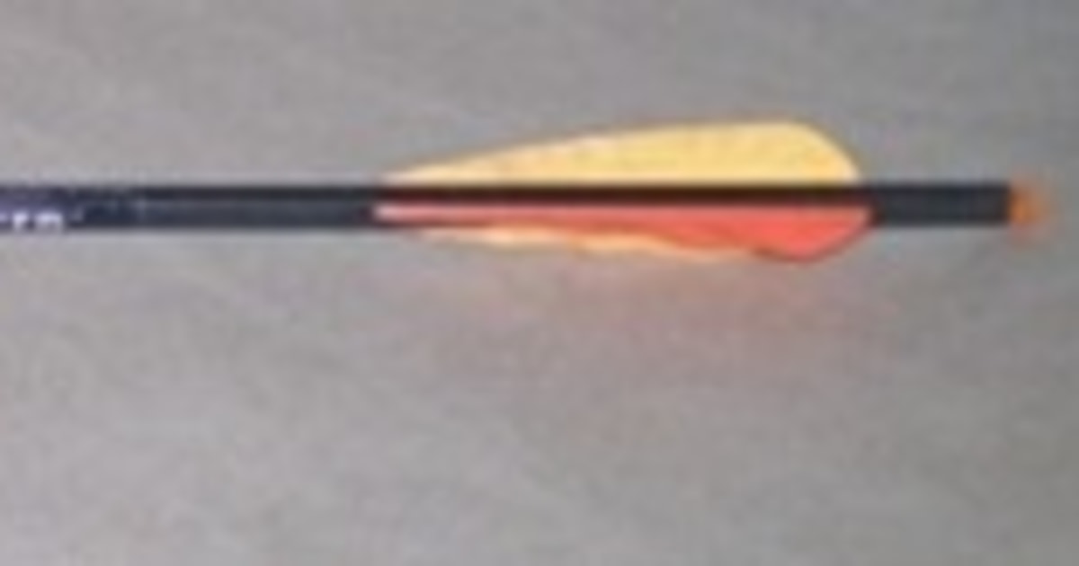 'It was scared, I was shaking': Calif. girl struck by arrow recalls ordeal