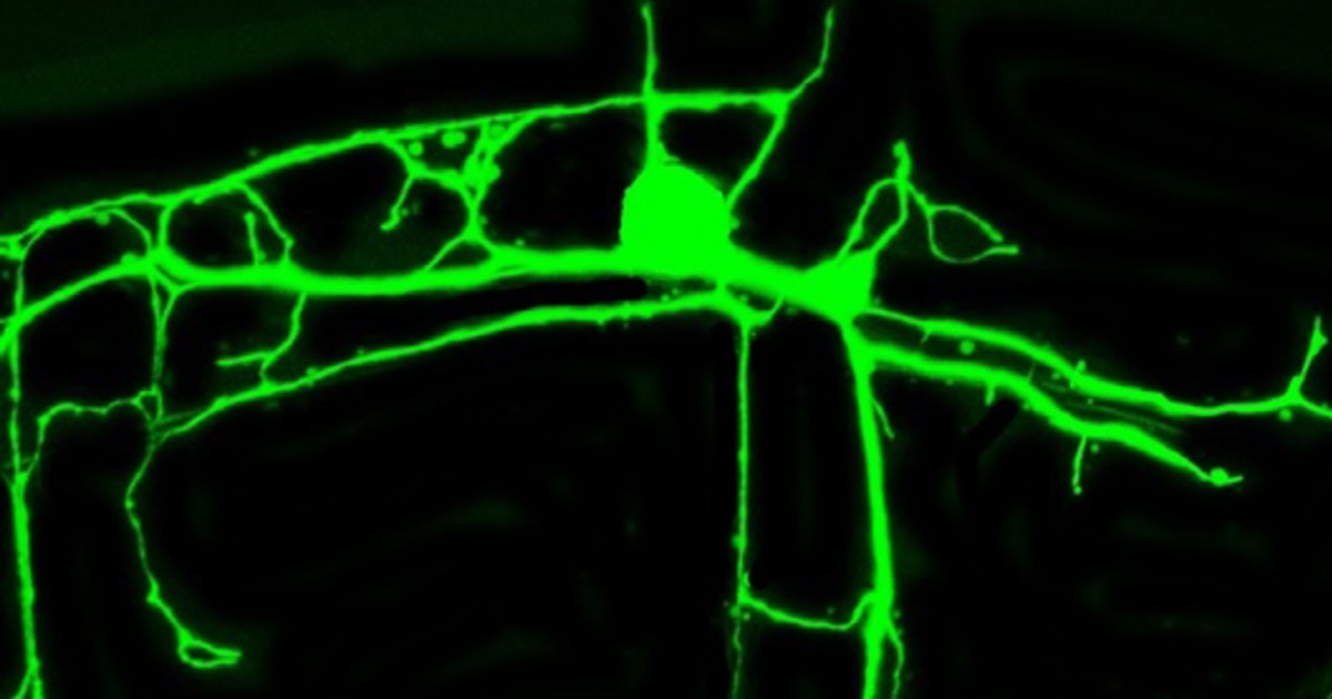 Worms tell a tale of how nerves develop