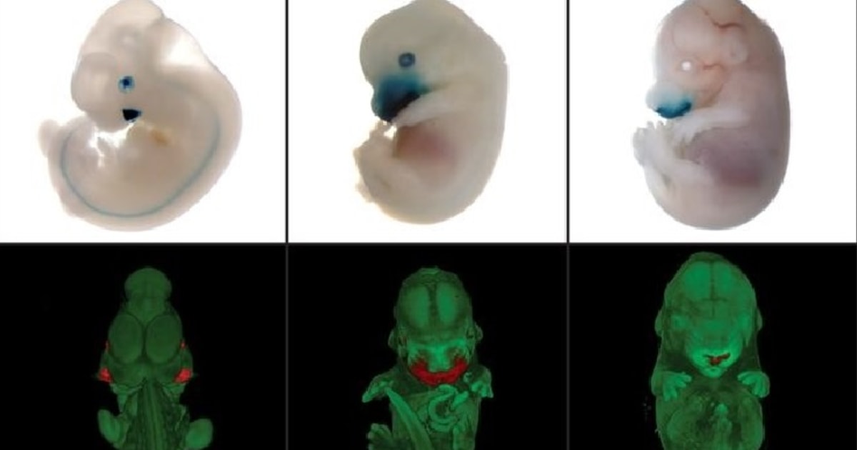 No offense, but your face might be shaped by 'junk' DNA