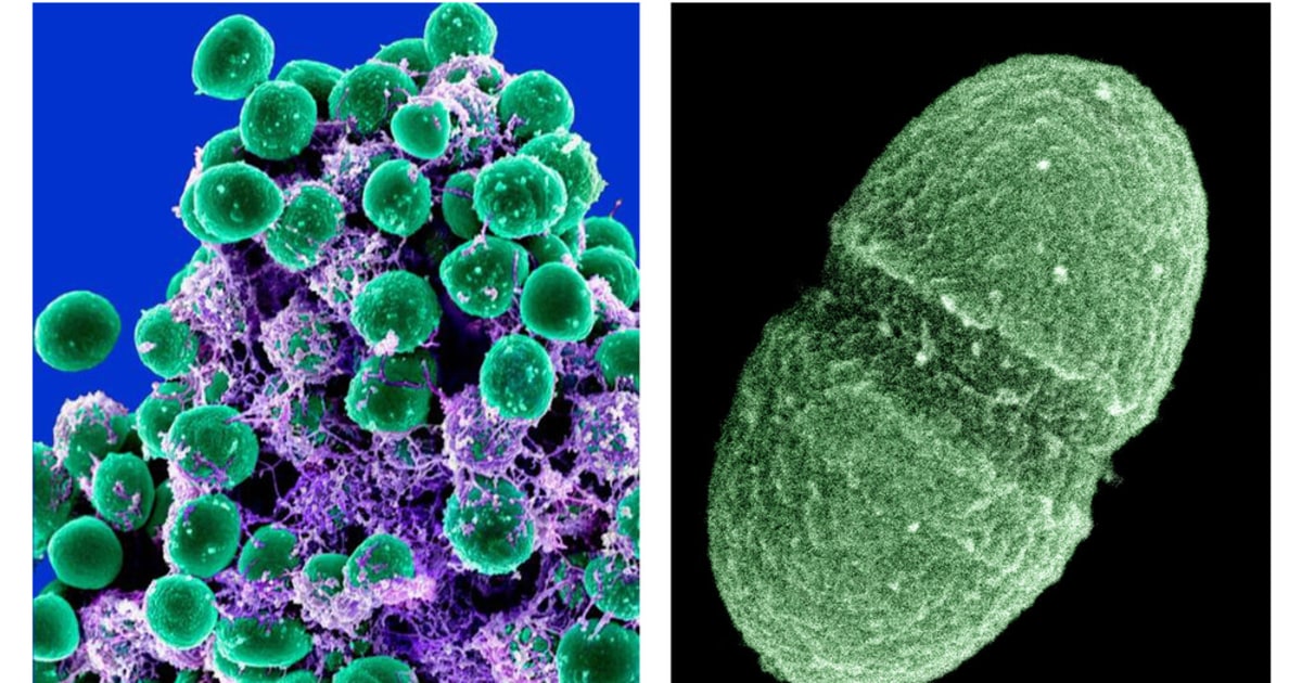 Scientists home in on 'good' gut germs for weight loss, health