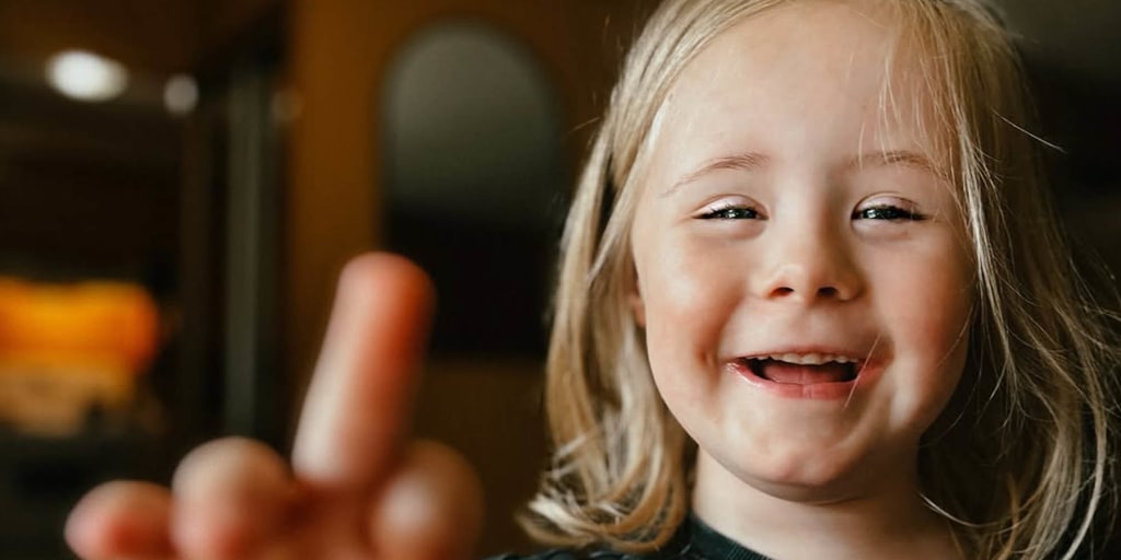 Downs Syndrome Hands Why Children With Down's Syndrome Are Predisposed