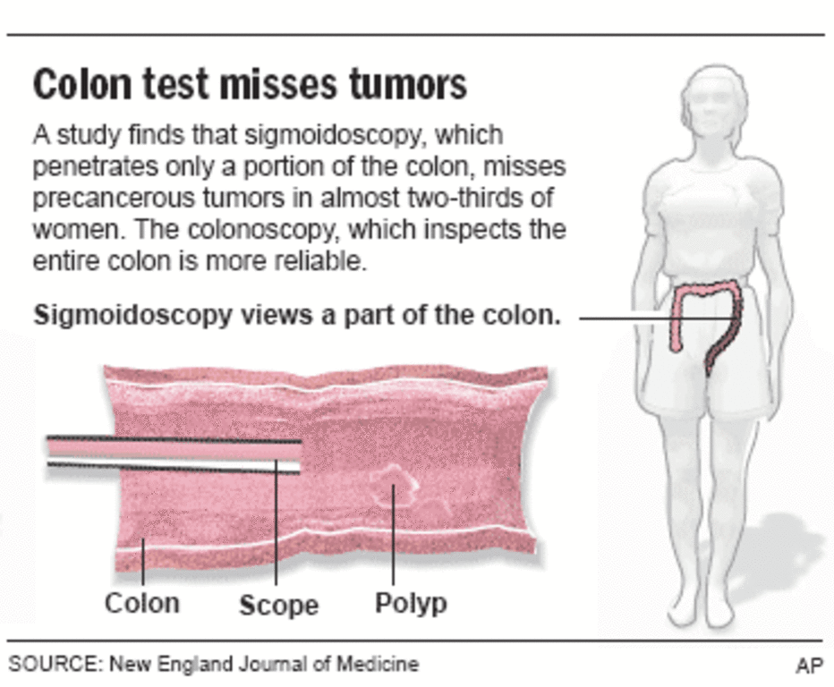 sigmoidoscopy test