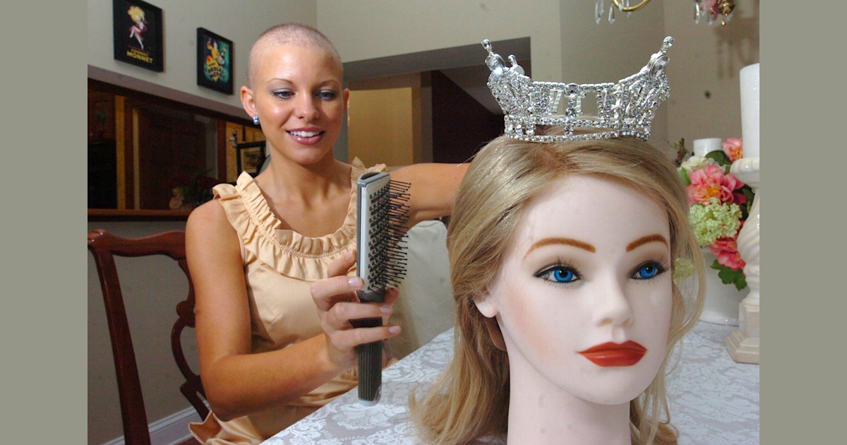 Your new Miss America might be beautiful — and bald