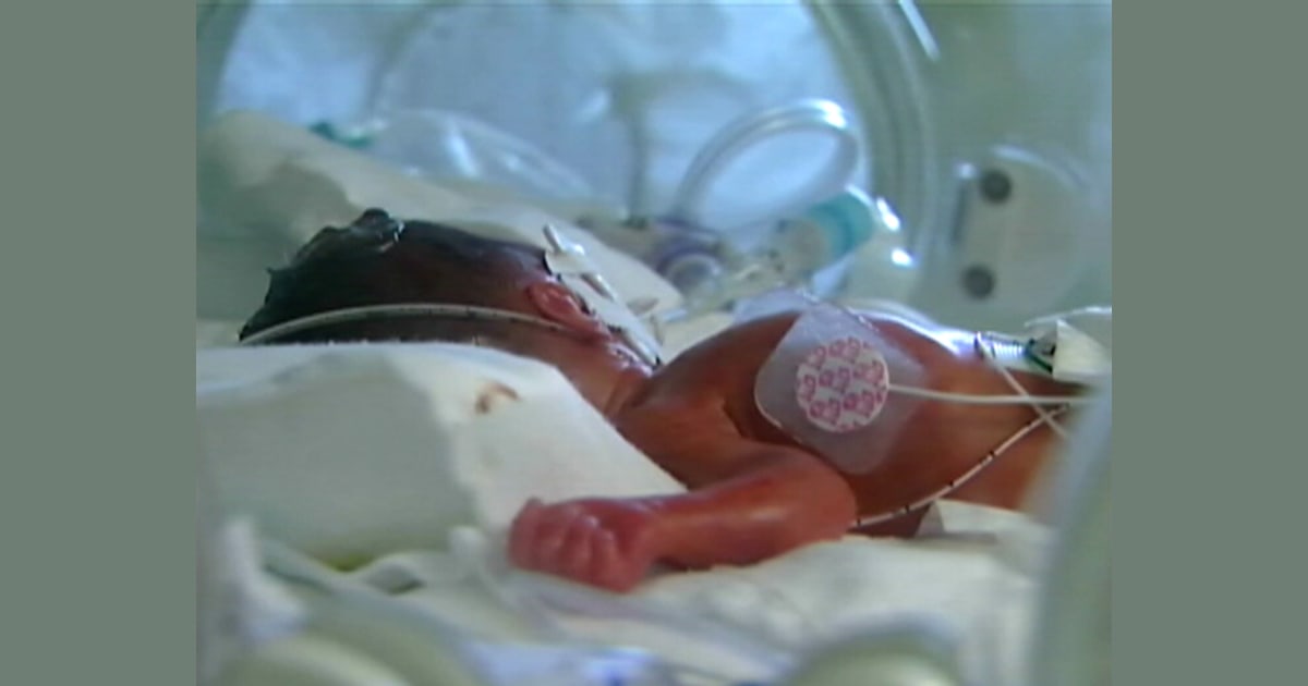 Parents of twins give birth to quintuplets