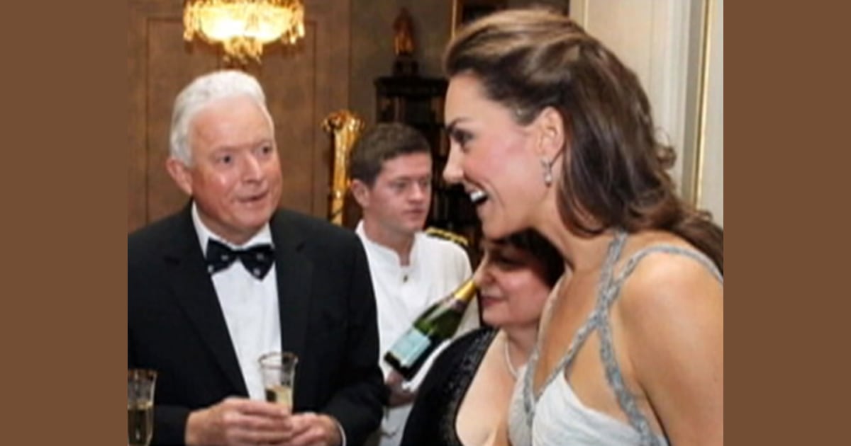 Kate Middleton reveals scar on her head