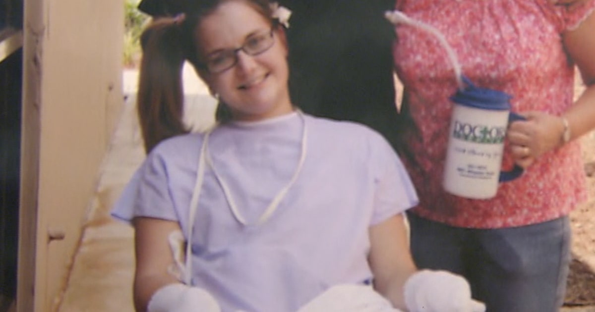 Doctors upgrade Aimee Copeland’s condition to good