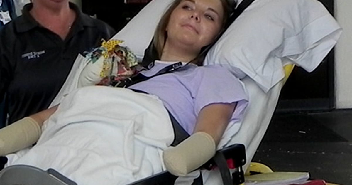 Aimee Copeland able to feed herself