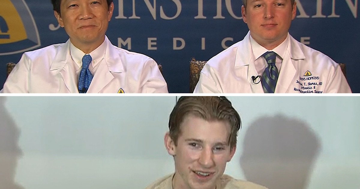 Doctors: Arm transplant vet ‘very determined'