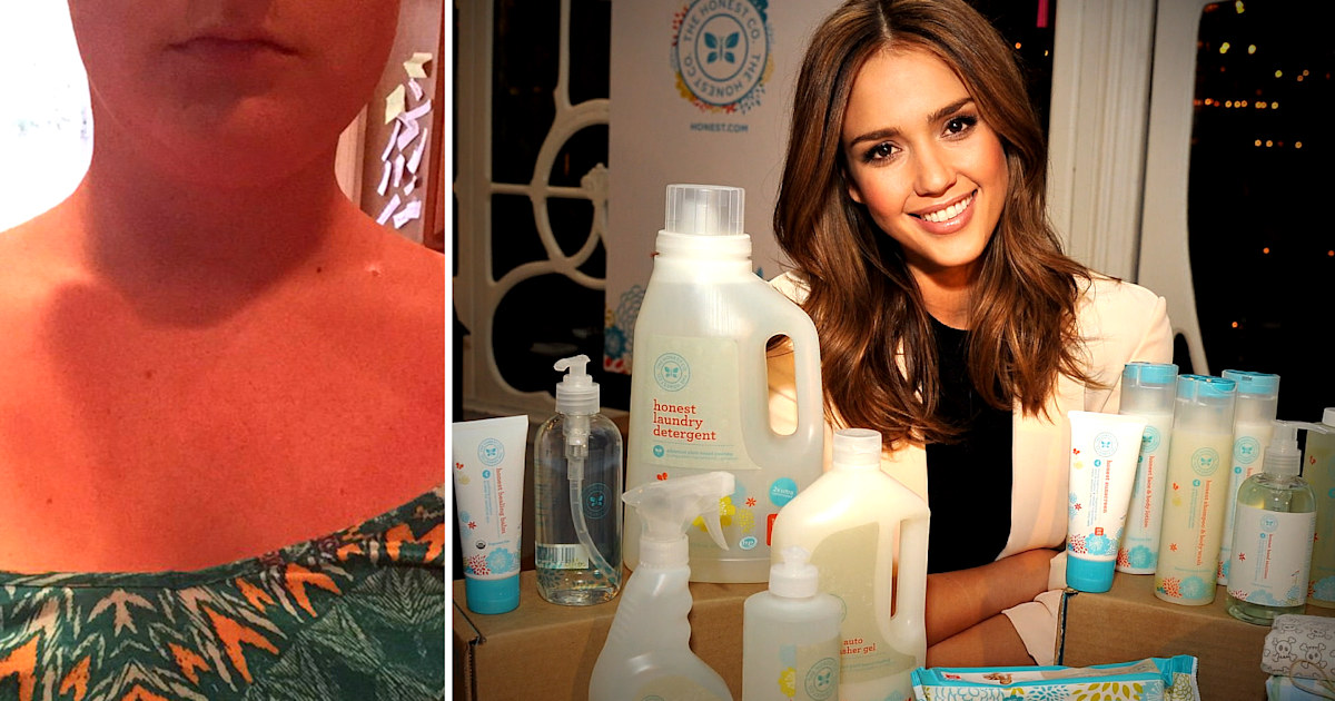 Jessica Alba’s Honest sunscreen has some users burning mad
