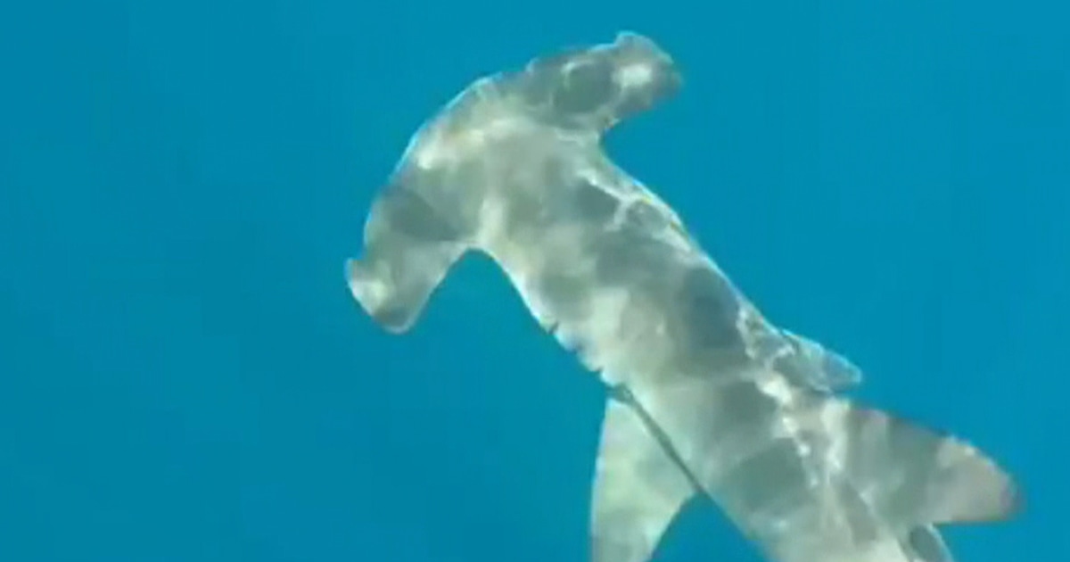 Shark Bite Victim Speaks Out As Shark Attack Season Winds Down