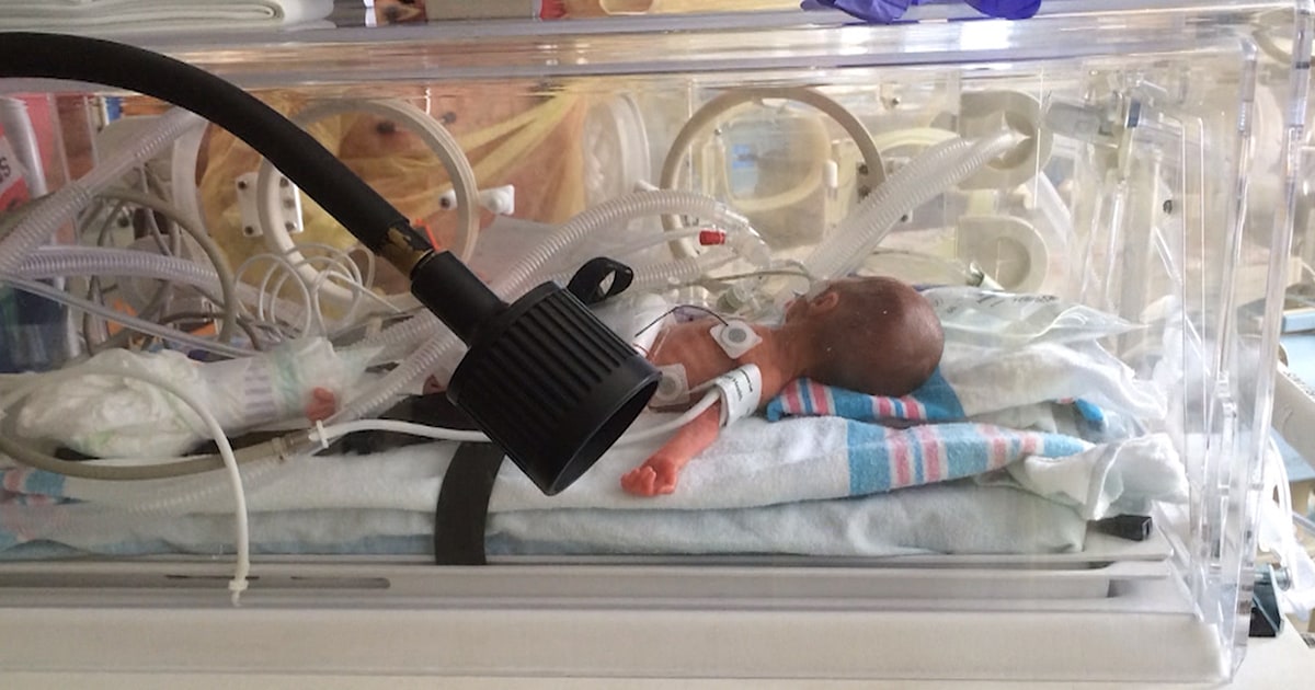 Miracle baby survives premature birth aboard cruise ship