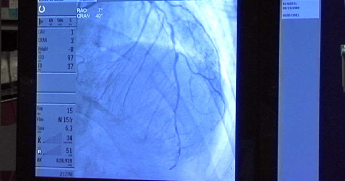 Men have heavy hearts (compared to women)