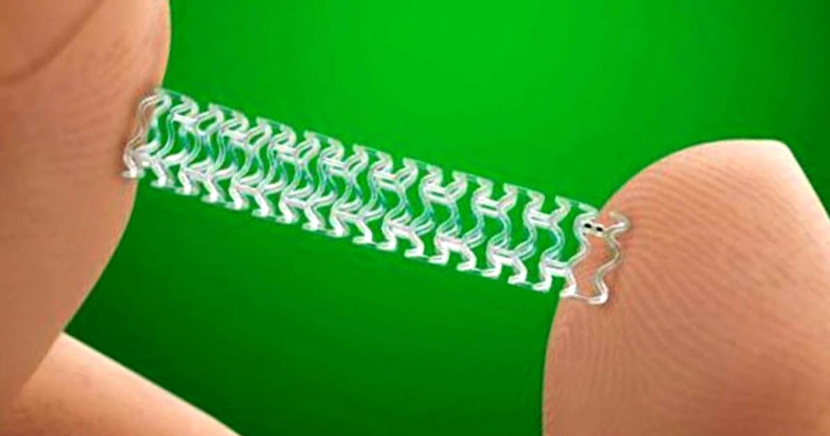 Dissolving stent for arteries approved by FDA