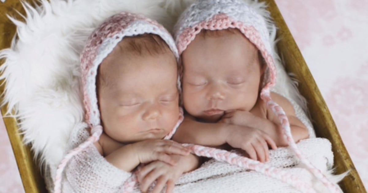 Twins hold hands just moments after birth