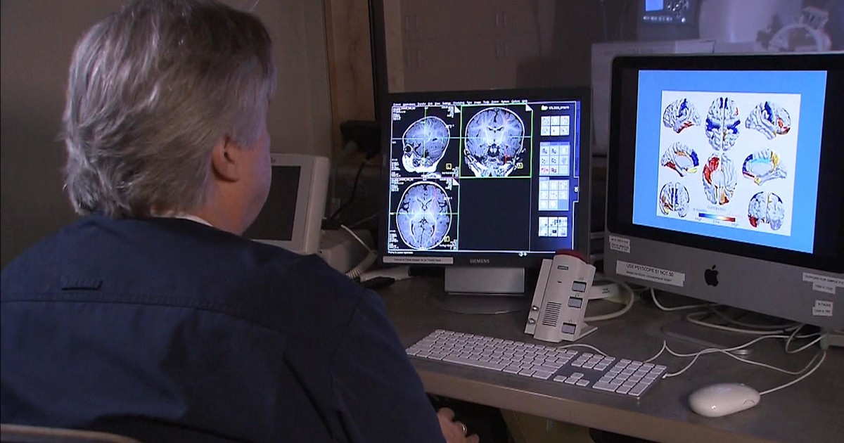 New test may be able to help diagnose autism as early as infancy