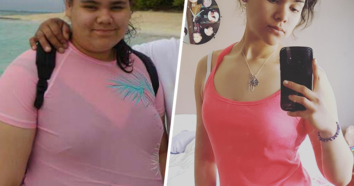 Teen who weighed nearly 300 pounds, loses half her size