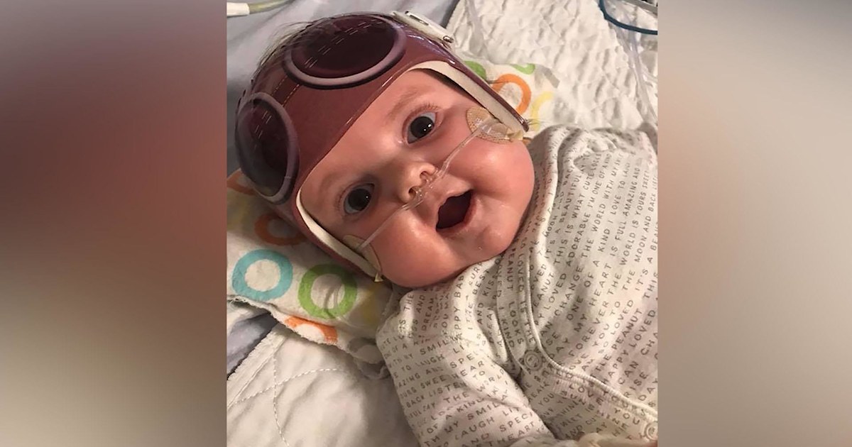 Baby born with half of a heart is now thriving, thanks to transplant