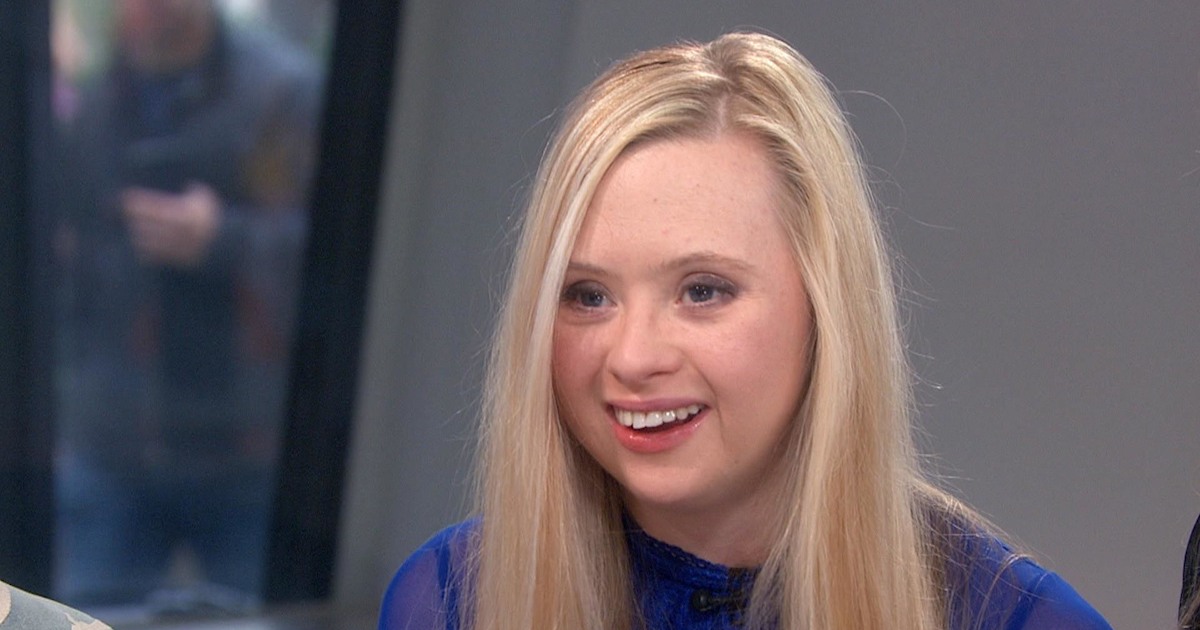 Model with Down syndrome is breaking barriers in fashion