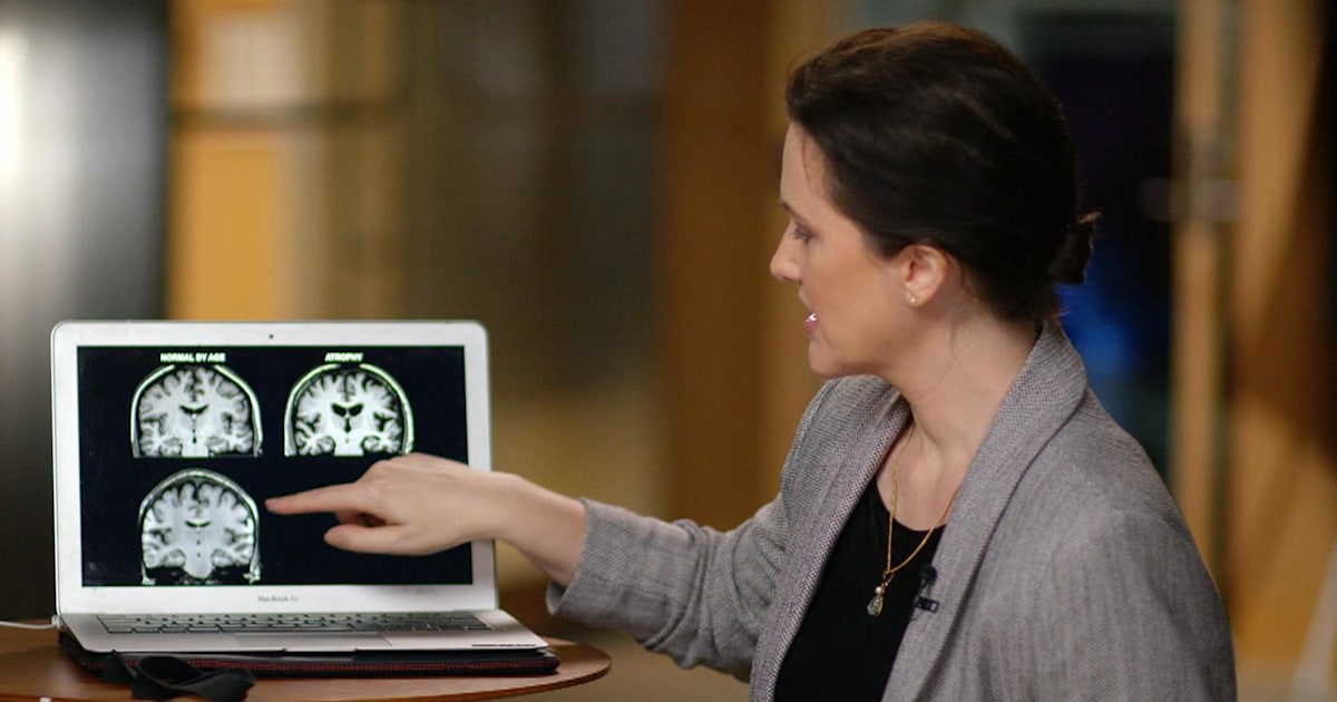 Neuroscientist studies possible link between Alzheimer’s and menopause