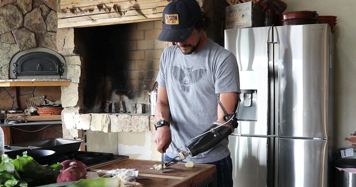 Meet the amputee chef who got a second chance after near-deadly accident