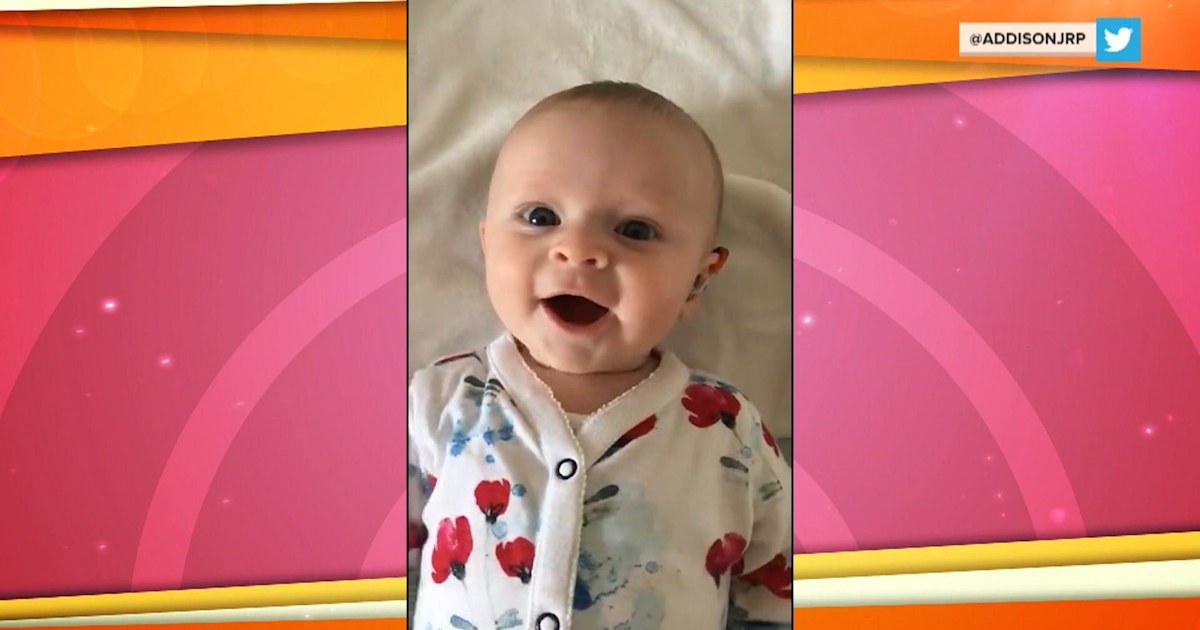 Watch this baby hear her mother’s voice for the first time