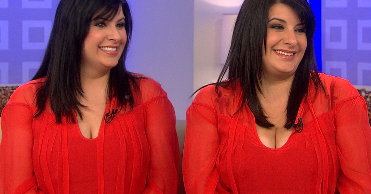 Inseparable twins: Siblings who can’t be parted