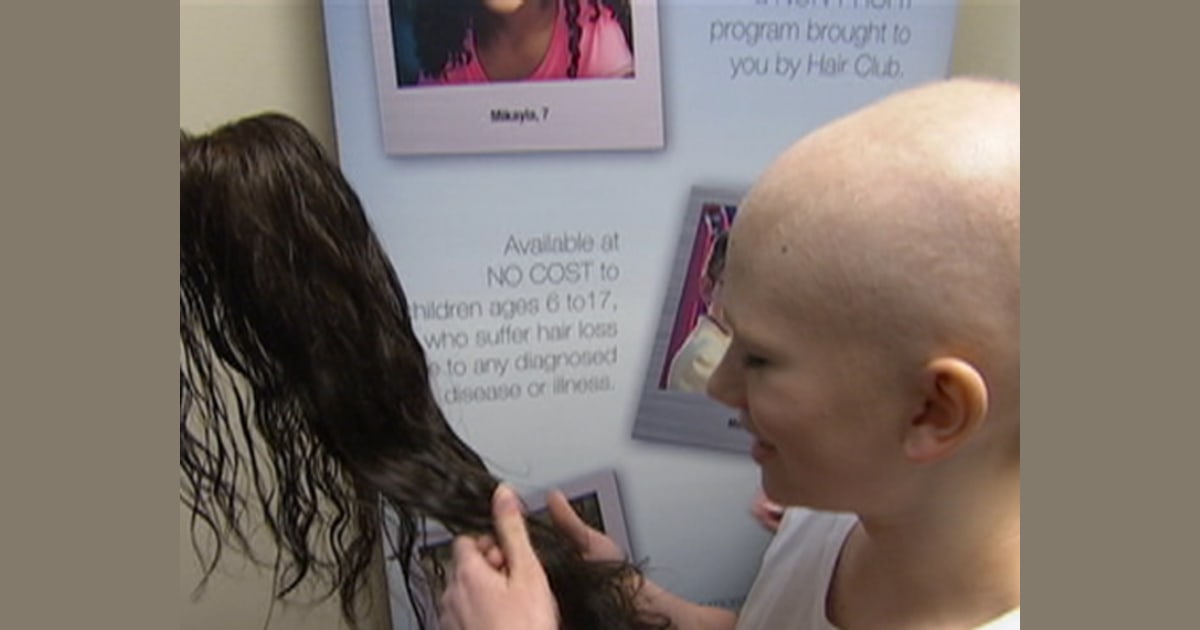 Teen girl with alopecia gets new hair