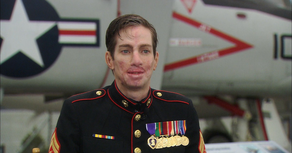 Marine on life after severe injury: 'Beauty is who you are'
