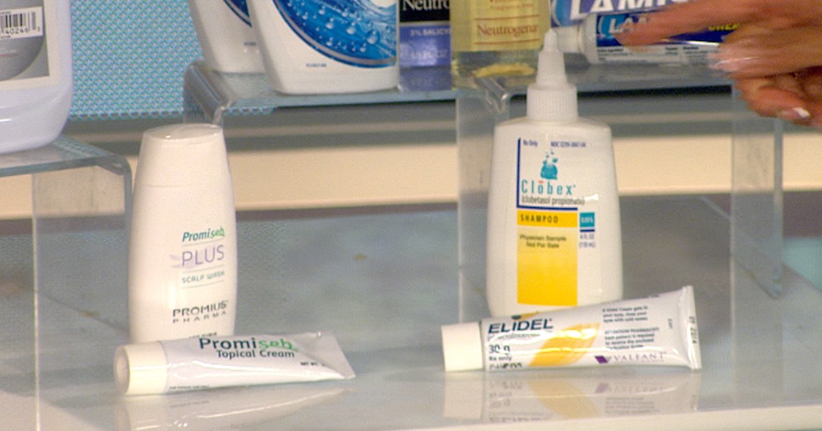 How to shake off dandruff for good