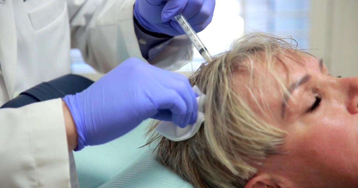 Here’s a list of hair loss treatment options for women