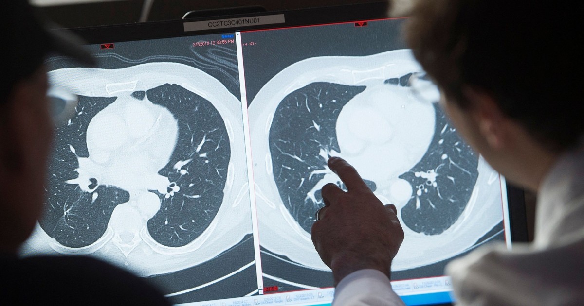 What does groundbreaking drug trial mean for other cancers?