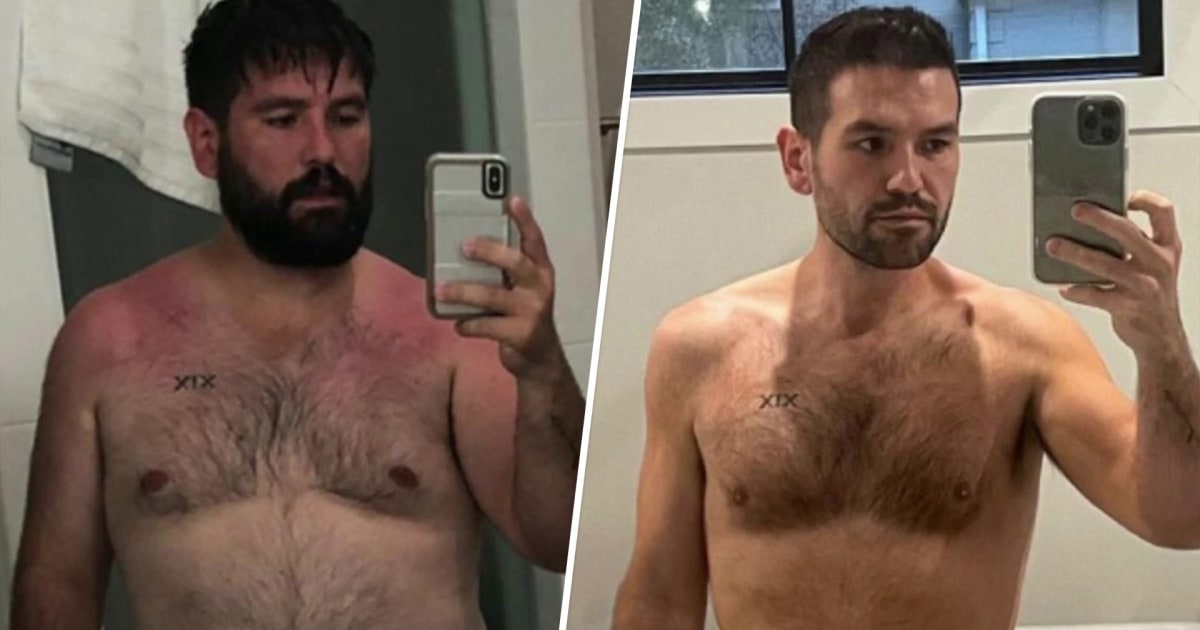 Shay Mooney shows 50-pound weight loss in before and after pics