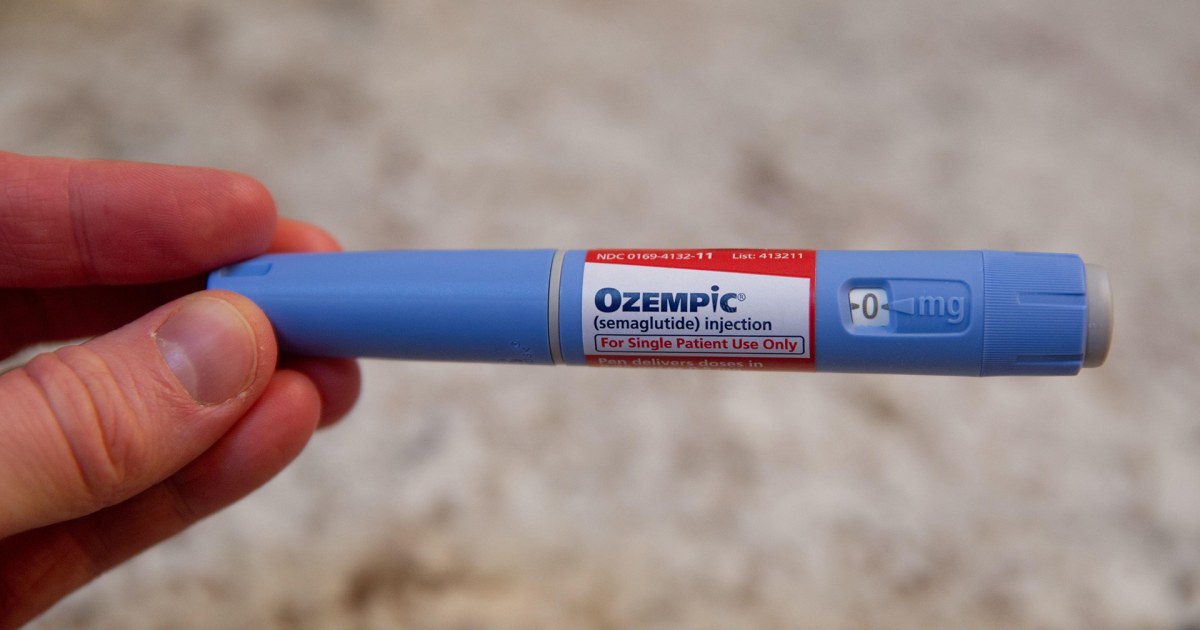 What is 'Ozempic face'? Unexpected side effect sparks complaints