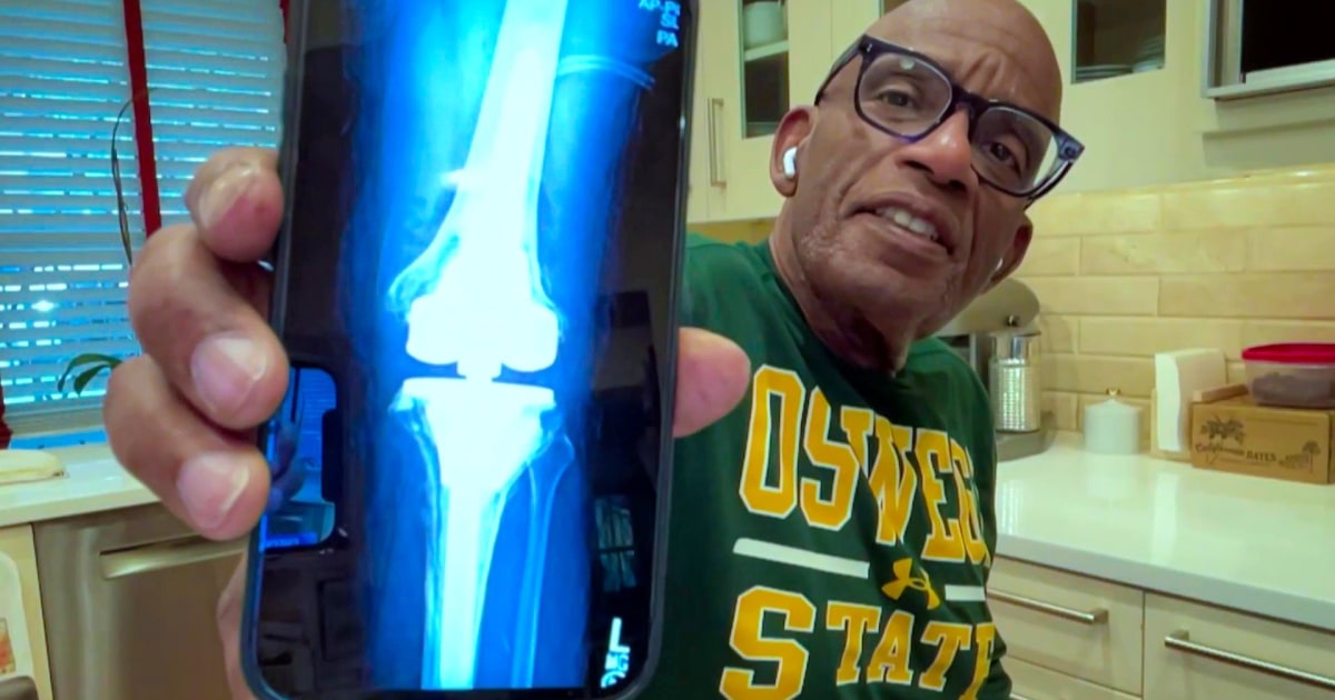 Al Roker says recent knee surgery was ‘toughest one yet’