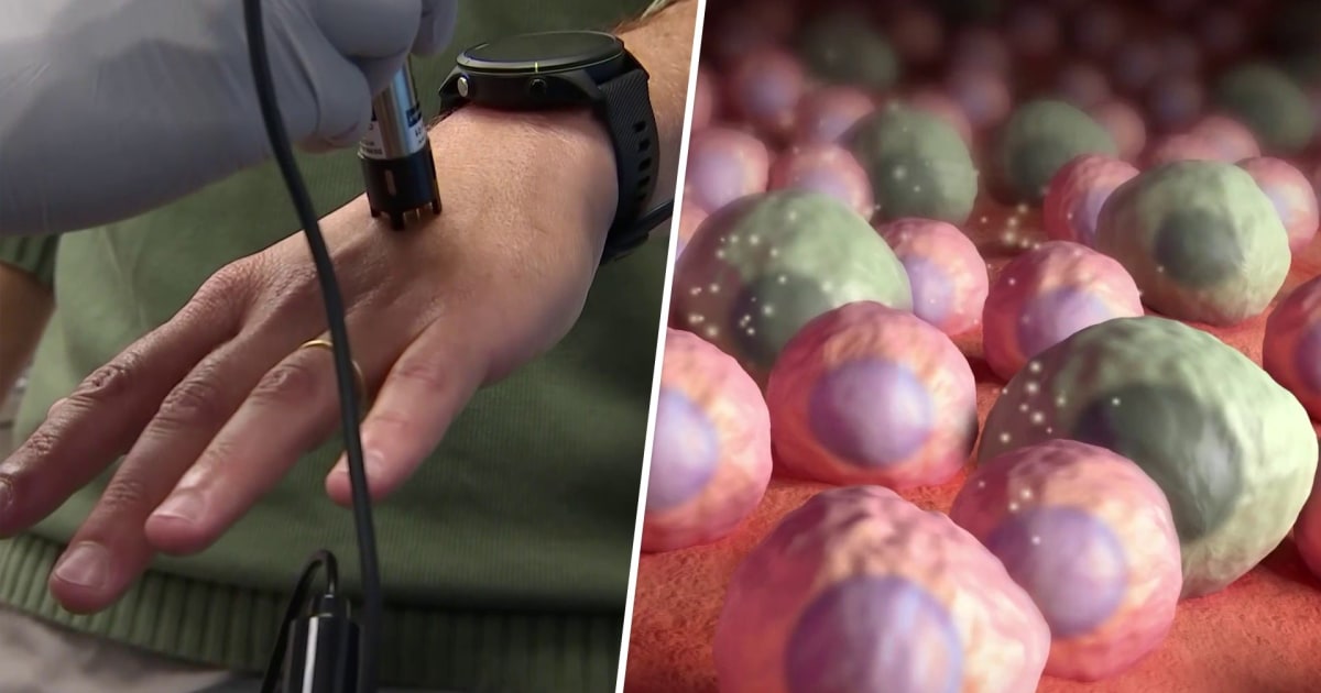 Are zombie cells the key to longer lives?