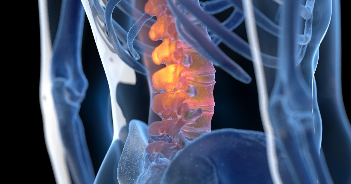 Drug-free treatment offers hope to patients with back pain