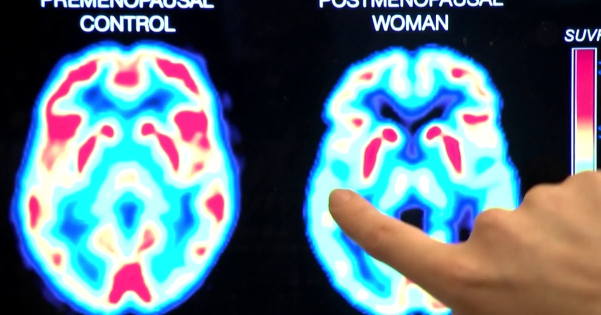 What is ‘menopause brain’ and how can people navigate it?