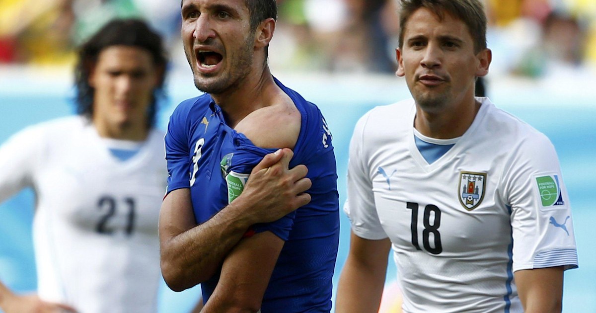 Bite club: Luis Suarez's bite is an icky aggressive instinct