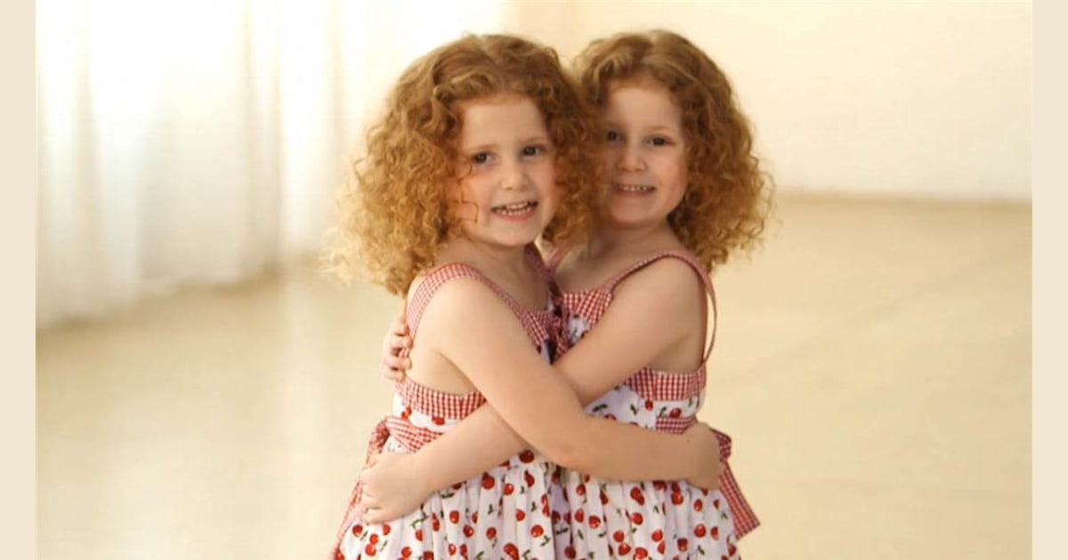 Being a twin: Is it all it's cracked up to be? Being a twin: Is it all it's cracked up to be?