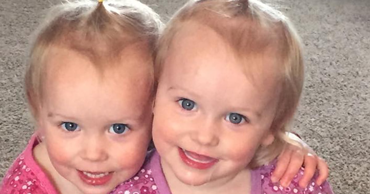Twin Power 17 Stories About The Amazing Bond Between Twins