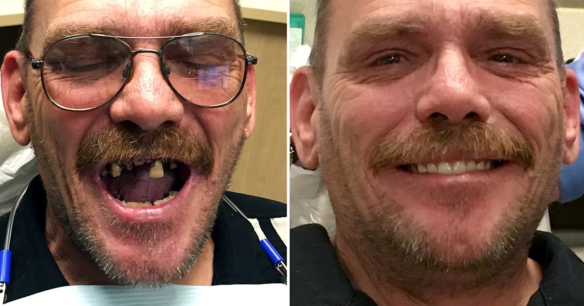 Arkansas veteran gets new teeth through free dental program